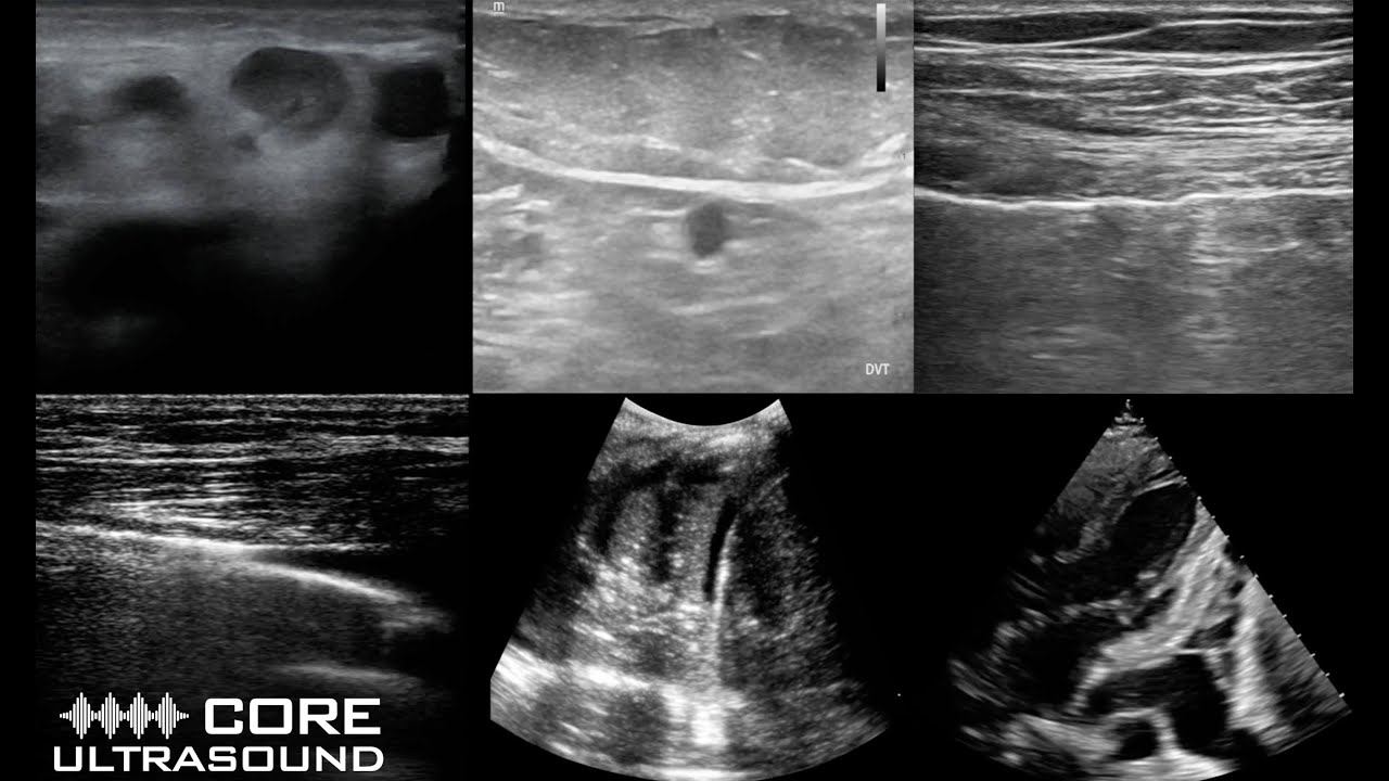 Core Ultrasound Image Review #2 - YouTube