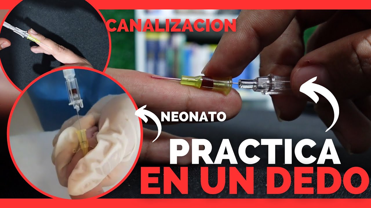 ¿Como CANALIZAR a un RECIEN NACIDO? | VENOCLISIS | 💉 Con DEMOSTRACION ...