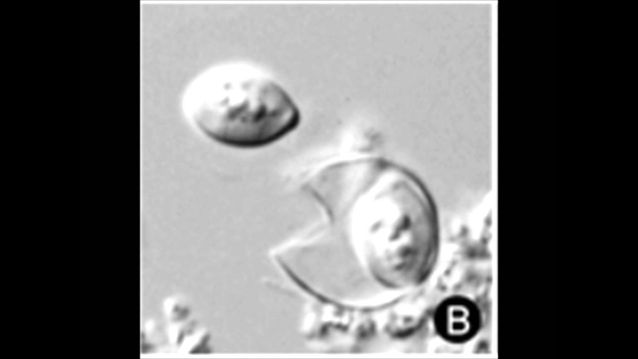Cyclospora spp Ciclo de vida - YouTube
