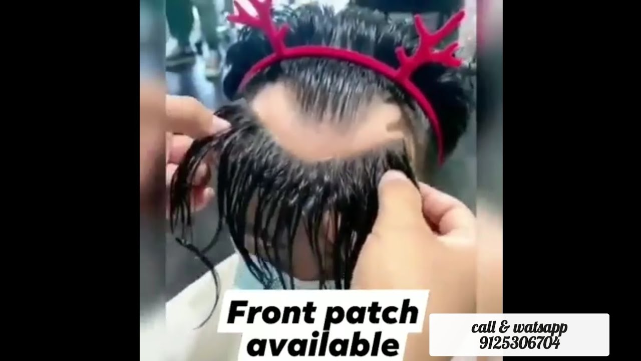 Front patch | front hairline patch | front hair line patch price ...