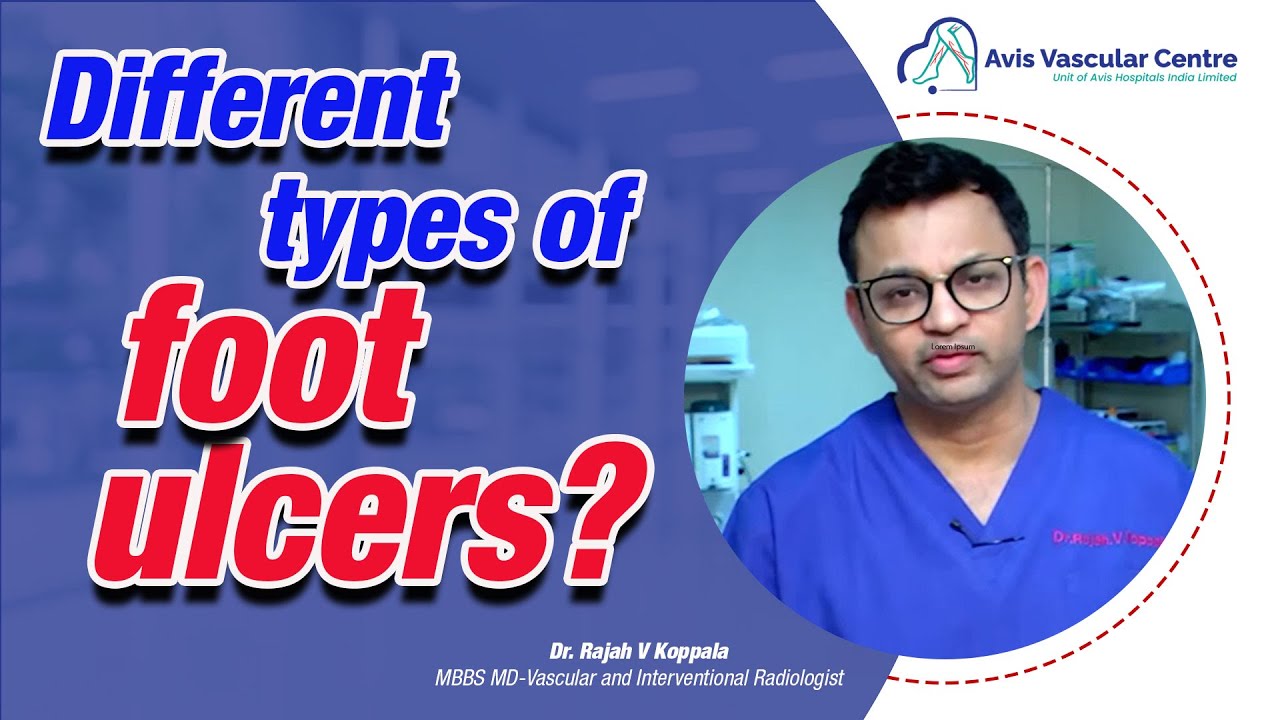 3 Types of Foot Ulcers Explained by Dr. Rajah V Koppala | Avis ...