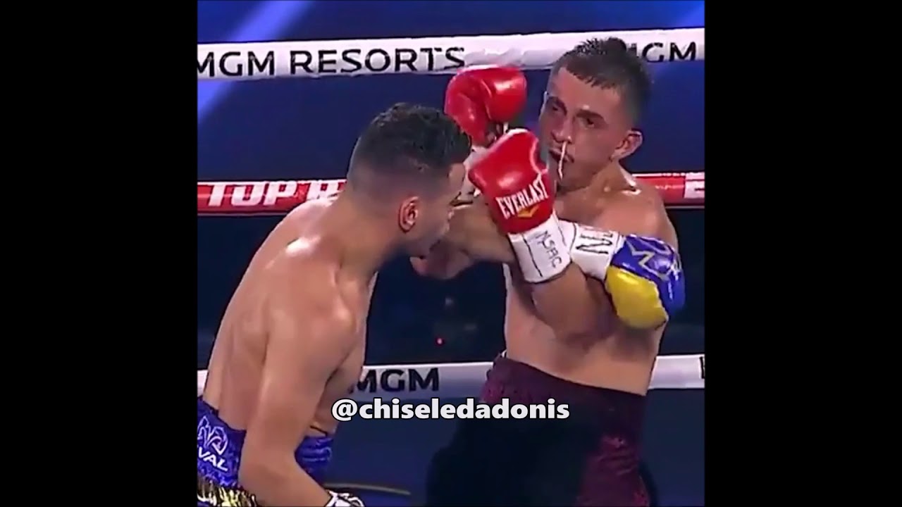 Boxer Heals Nasal Congestion For Opponent - YouTube