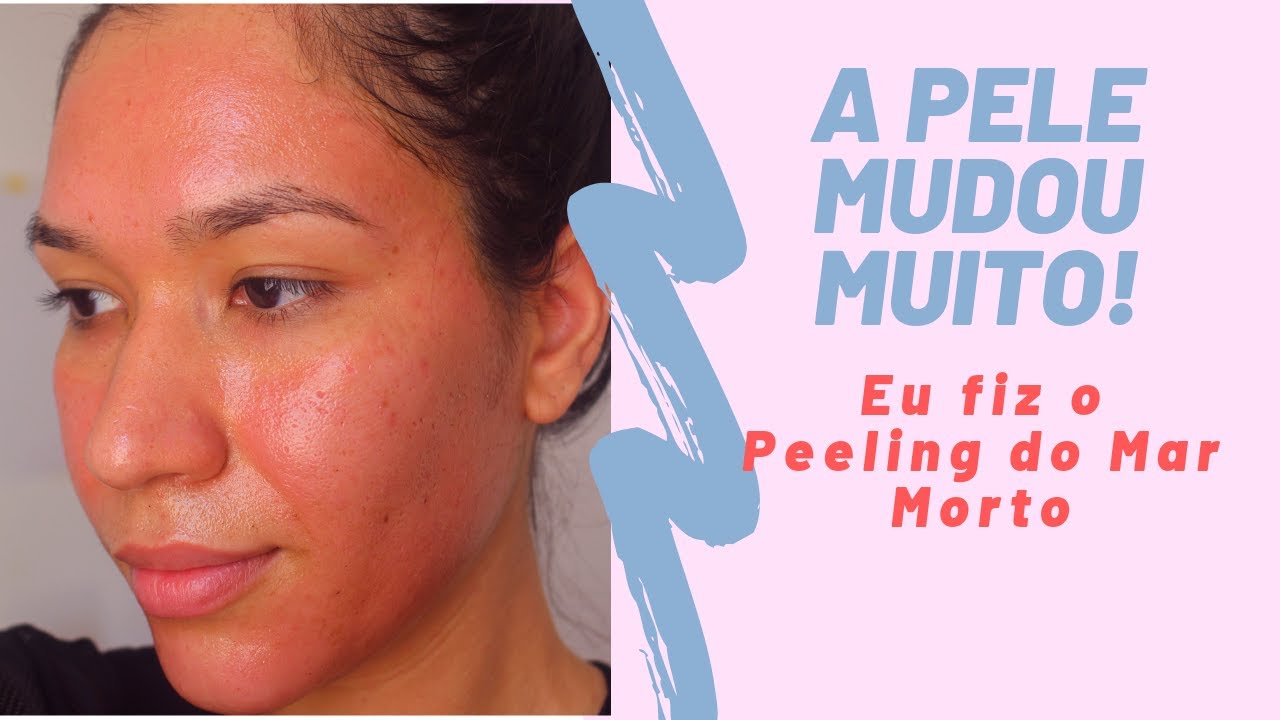 PELE DE BEBÊ DE VERDADE | Minha experiência com PEELING MAR MORTO ...