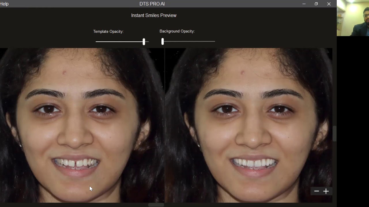 DTS PRO 15.9 tutorial webinar - YouTube