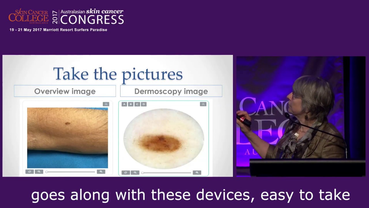 Skin Lesion Photography - YouTube