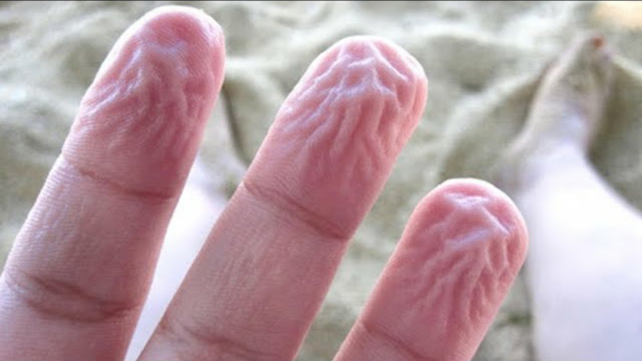 Why are fingers get wrinkly in underwater?-Scientia to know. - YouTube
