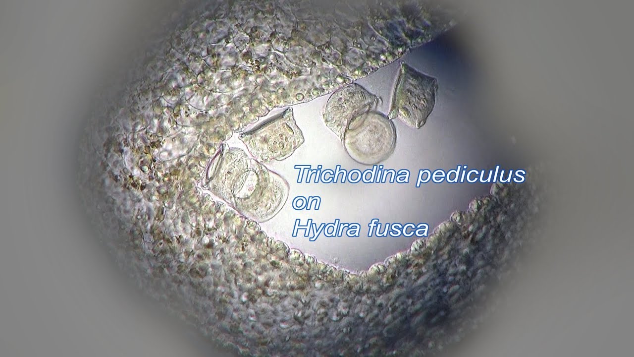 TRICHODINA PEDICULUS on HYDRA FUSCA - YouTube