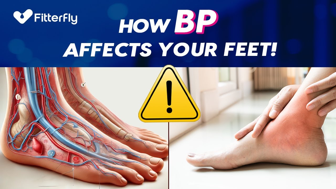 Why High Blood Pressure Causes Leg and Foot Swelling Explained! - YouTube
