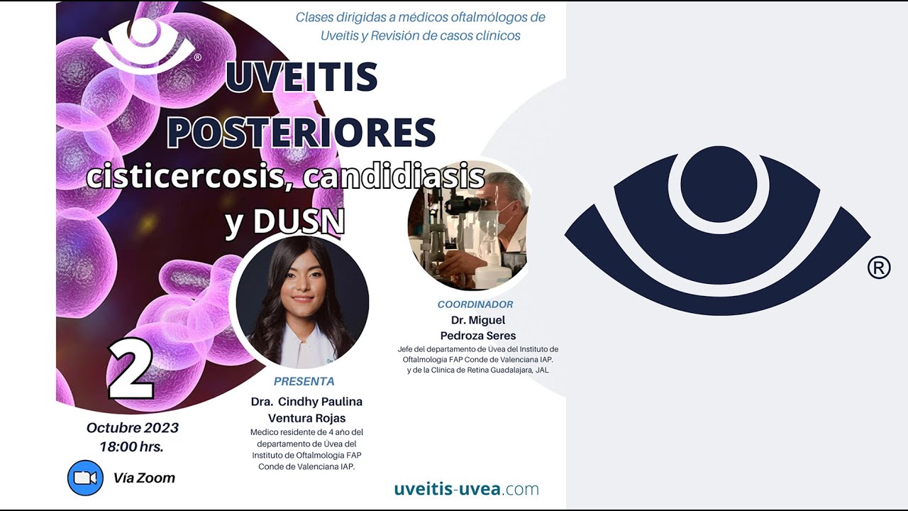 Uveitis Posteriores cisticercosis, candidiasis y DUSN - YouTube