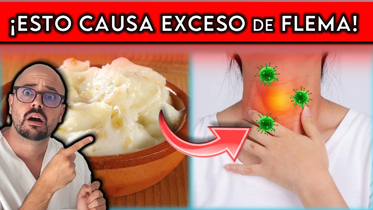 5 ALIMENTOS que causan MOCO y FLEMA EN LA GARGANTA || ¡REMEDIOS para eliminar MOCOS! - YouTube
