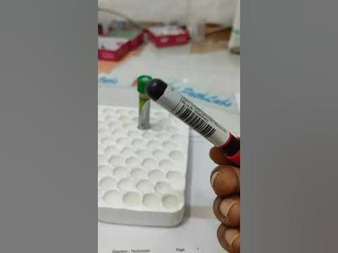 QC/ABX Difftrol run process in ABX PENTRA XL 80 | QUALITY CONTROL RUN IN PENTRA XL 80 | ABX ...