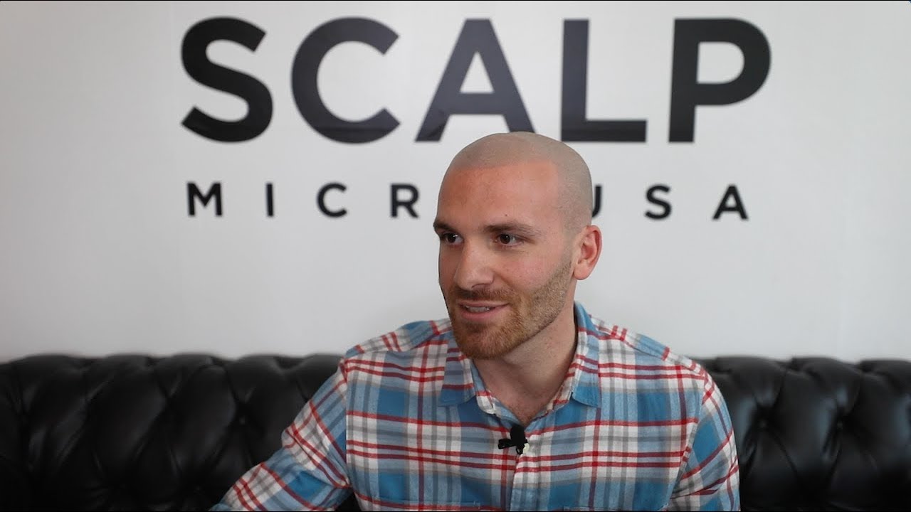 Matt’s AWESOME Scalp Micropigmentation Transformation | Scalp Micro USA ...