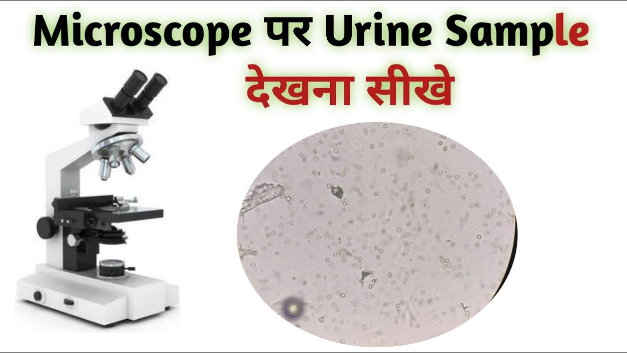 Urine Under Microscope Youtube