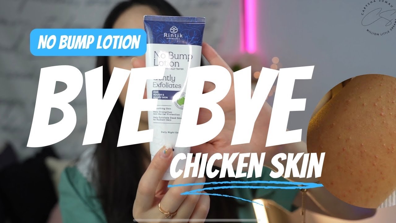 CARA MENGATASI CHICKEN SKIN | KERATORIS PILARIS No Bump Lotion by ...