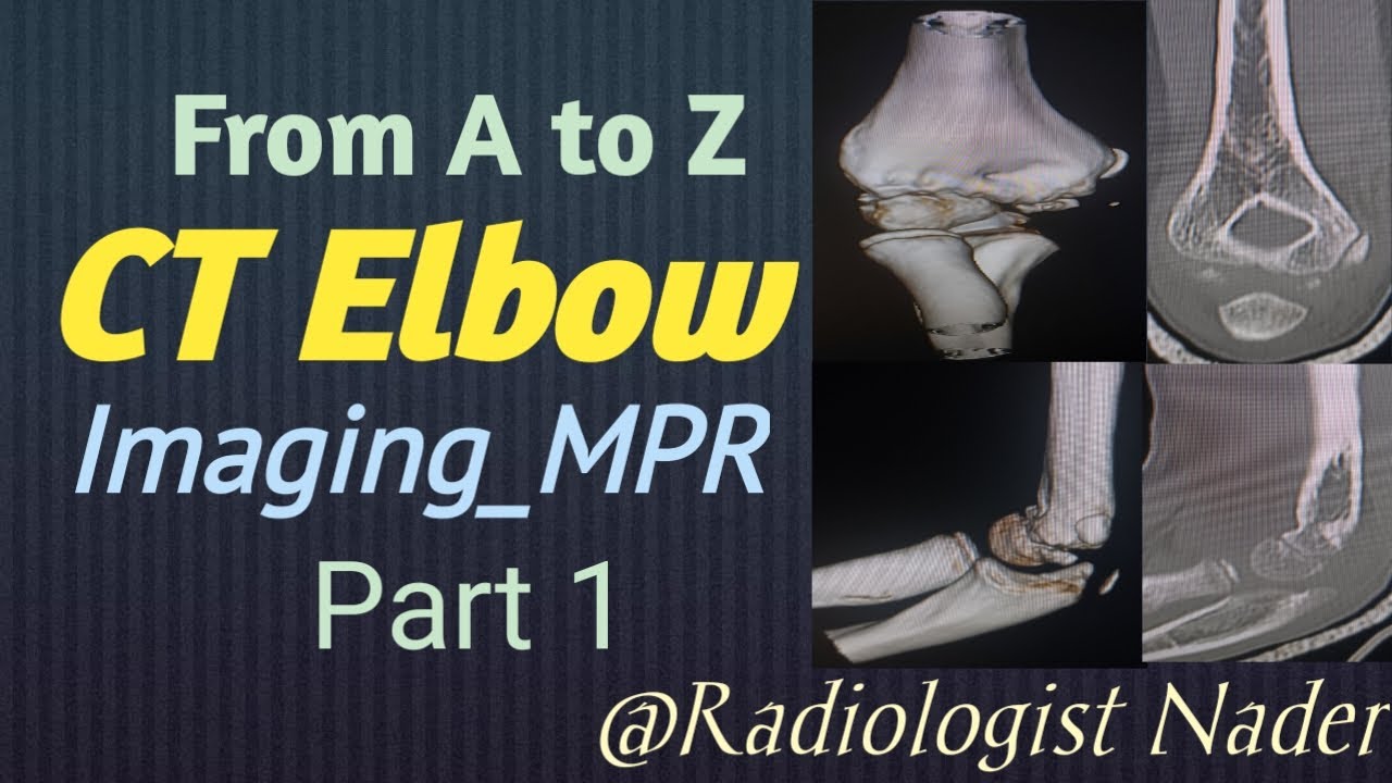 اشعة مقطعية علي مفصل الكوع|الجزء الاول|تصوير|ريفورمات|CT Elbow Joint ...