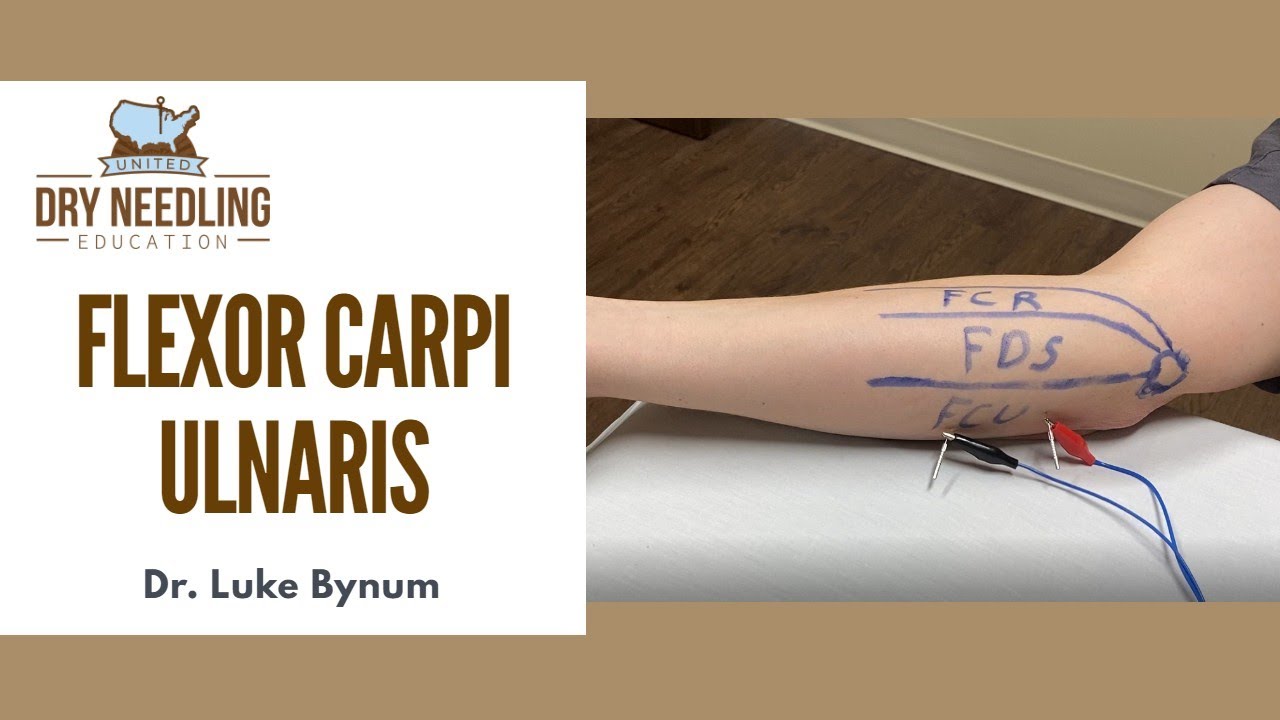 Dry Needling Flexor Carpi Ulnaris - YouTube