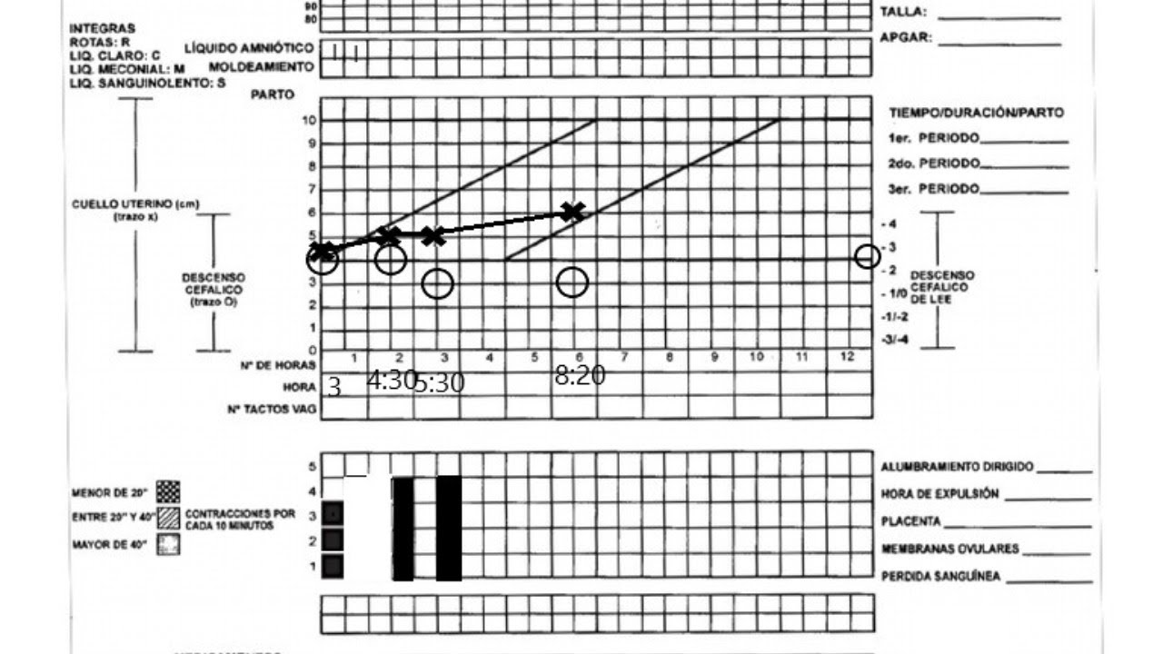 Llenado del Partograma con Historias clínicas reales - YouTube