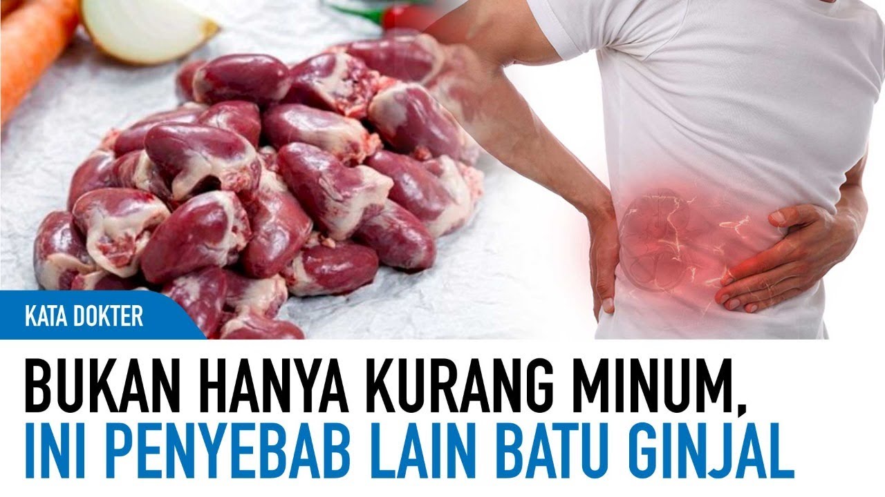 Berbagai Penyebab Batu Ginjal Terbentuk Kebiasaan Dan Makanan Kata