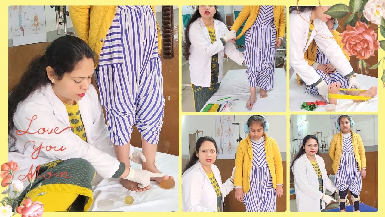 Ctev Or Club foot #Part2|Top 5 Magic Exercises for congenital talipus ...