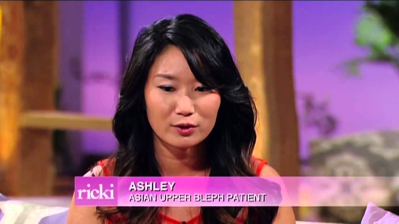 The Ricki Lake Show - Dr. Peter Newen Featured For Asian Double Eyelid ...