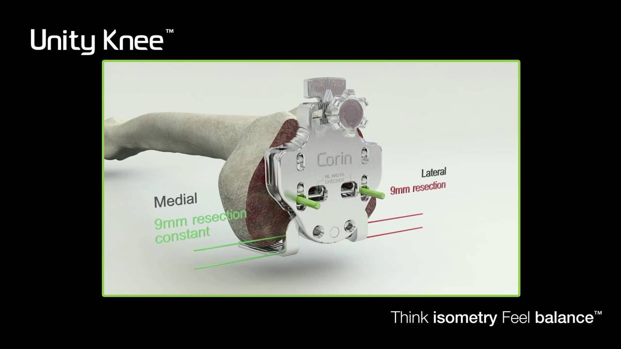 Unity Knee Product Overviewdescargaryoutube com - YouTube