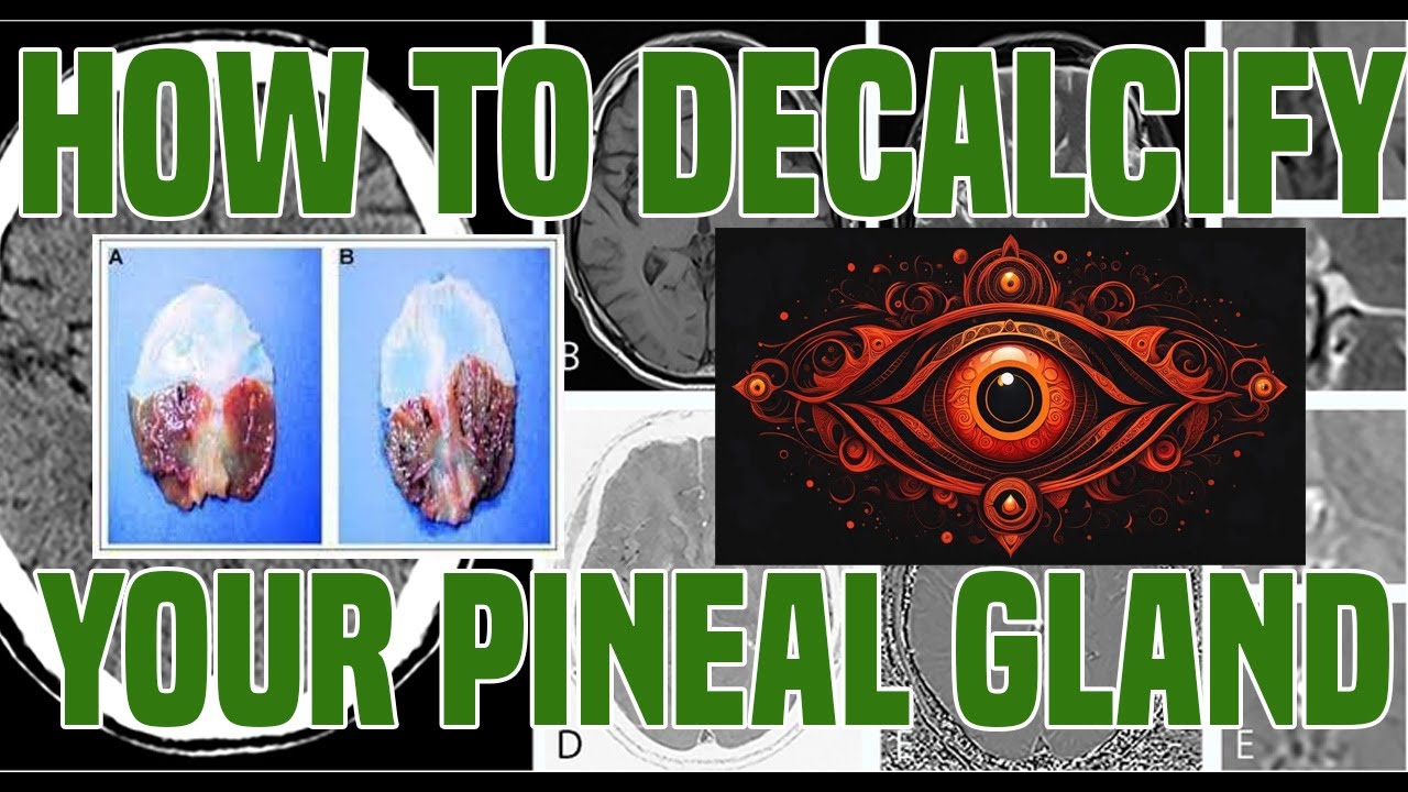 How to decalcify your pineal gland - EASY STEPS! - YouTube