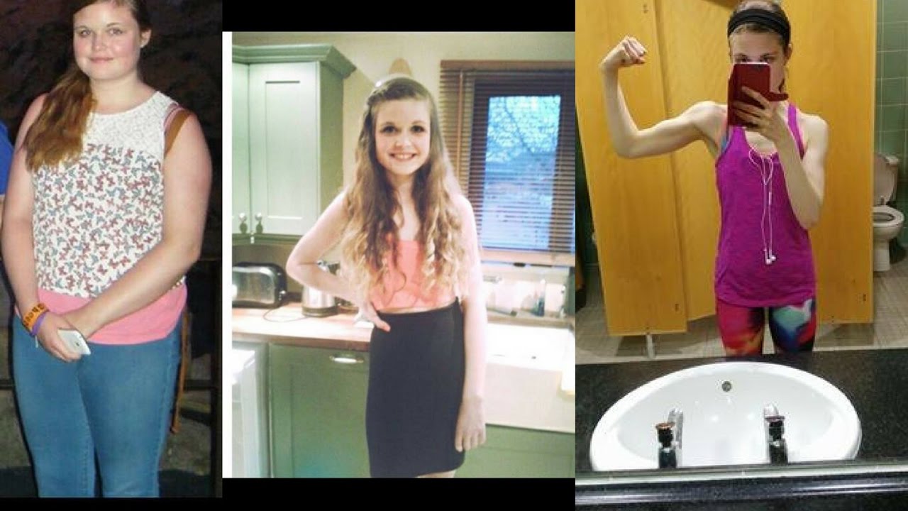 My Eating Disorder Story Part 2 With Pictures Youtube