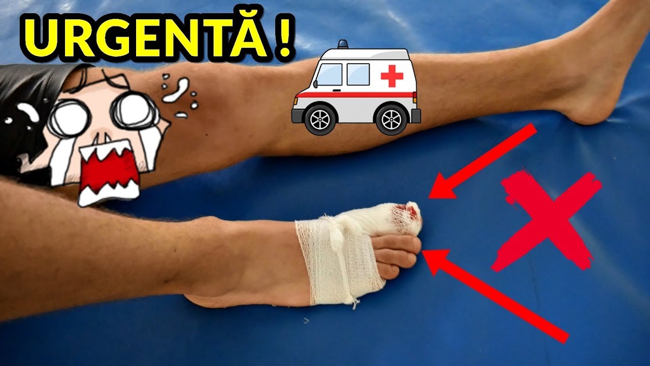 ȘI-A RUPT DEGETUL ! - YouTube