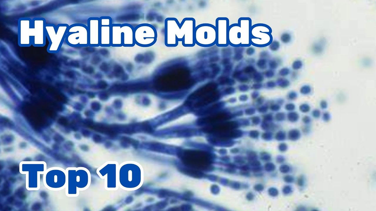 Top 10 Hyaline Molds - Laboratory Diagnosis - YouTube