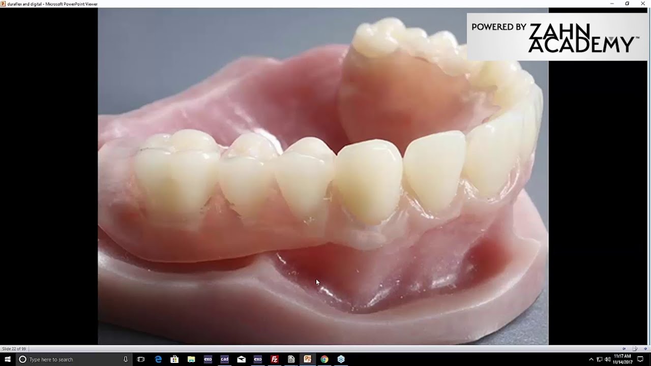 On-Demand Webinar: Myerson Duraflex Partials Step-By-Step - YouTube