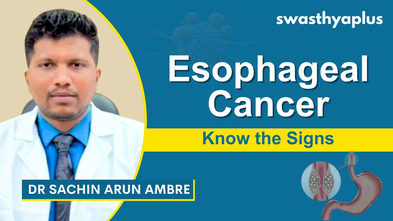 Esophageal Cancer: How to Treat? | Food Pipe Cancer | Symptoms | Dr ...