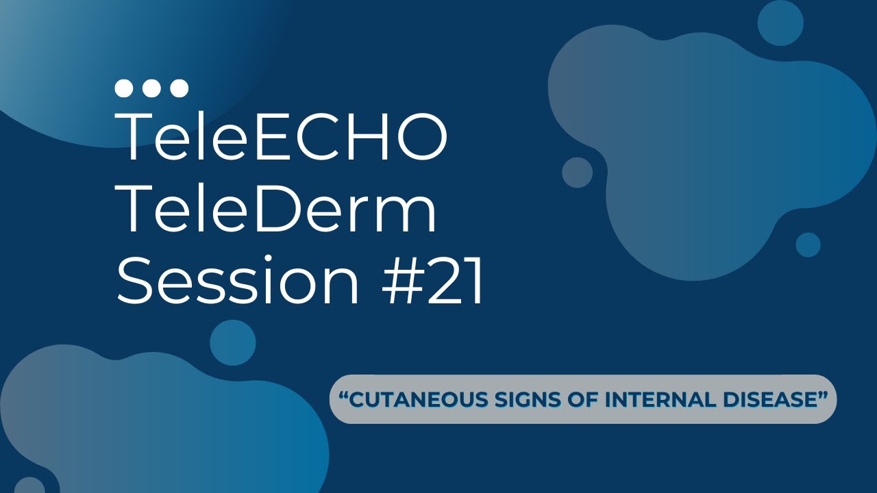TeleECHO TeleDerm Session #21 (02/05/2024) - “Cutaneous Signs of Internal Disease" - YouTube