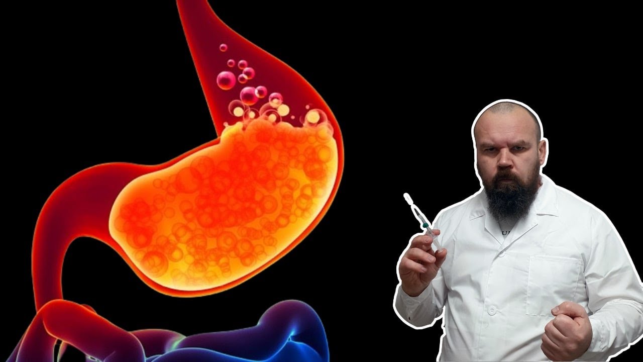 Wie man Gastritis heilt und sauren Reflux beseitigt. - YouTube