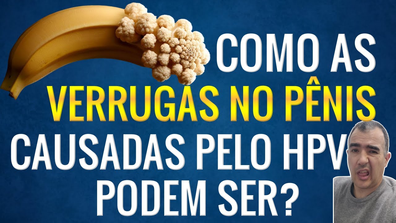 Como as verrugas no pênis causadas pelo HPV podem ser? - YouTube