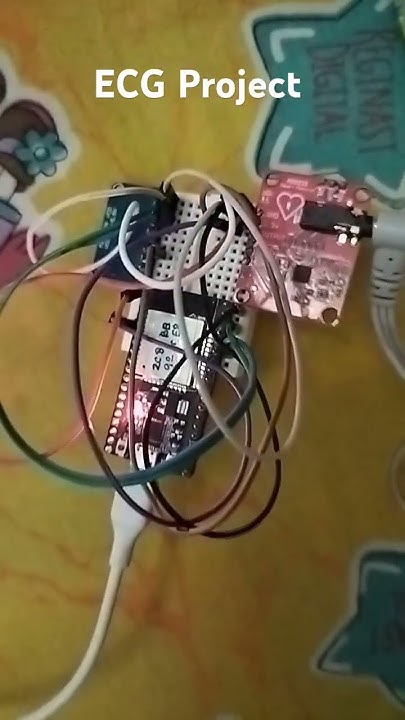 ESP32 ECG Monitor | Real-time ECG Waveform on OLED using ESP-NOW #arduino#esp32project #AD2832,# ...