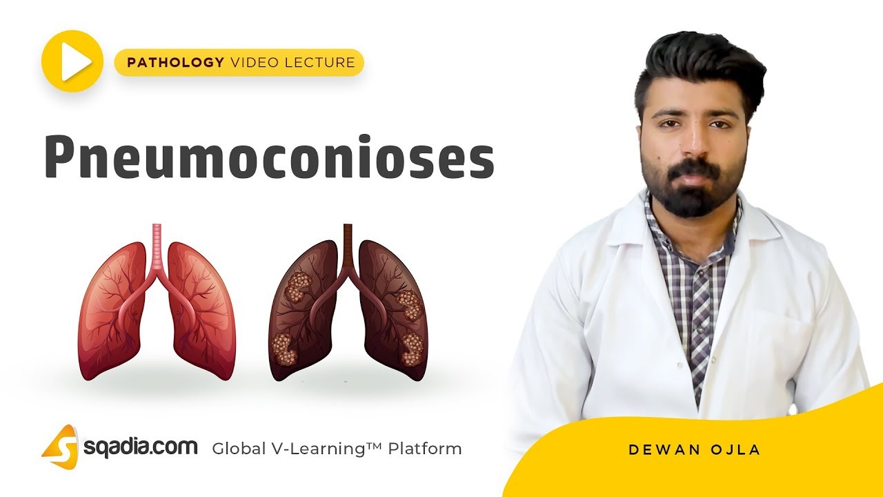 Pneumoconioses | Pathology Tutorials | Medical Education | V-Learning ...