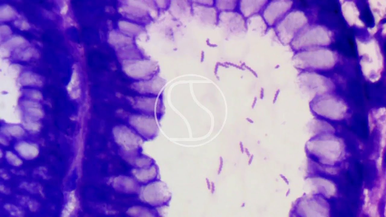 Helicobacter heilmannii under the microscope with Giemsa stain - YouTube