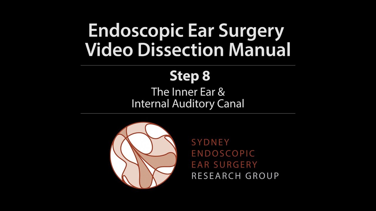 Step 8 - Sydney Endoscopic Ear Surgery Video Dissection Manual - YouTube