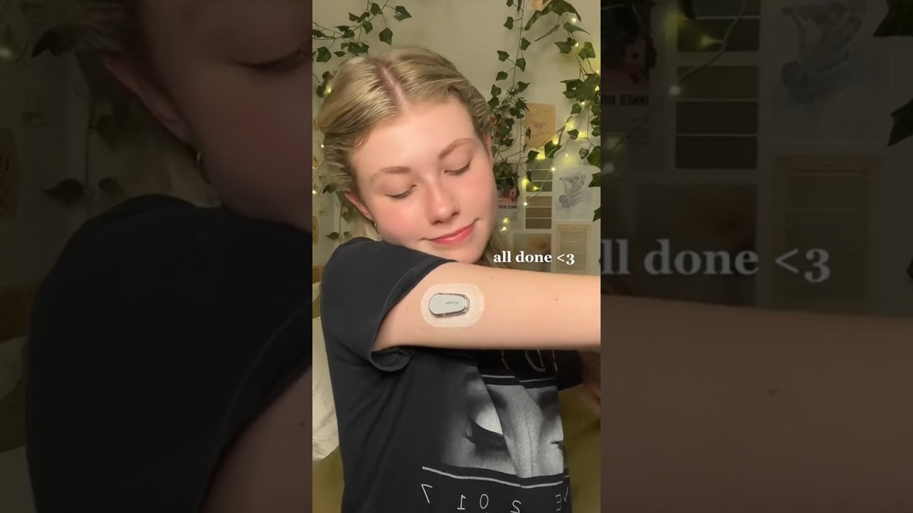 CGM forearm test #type1 #type1diabetes #diabetes #t1dlookslikeme # ...