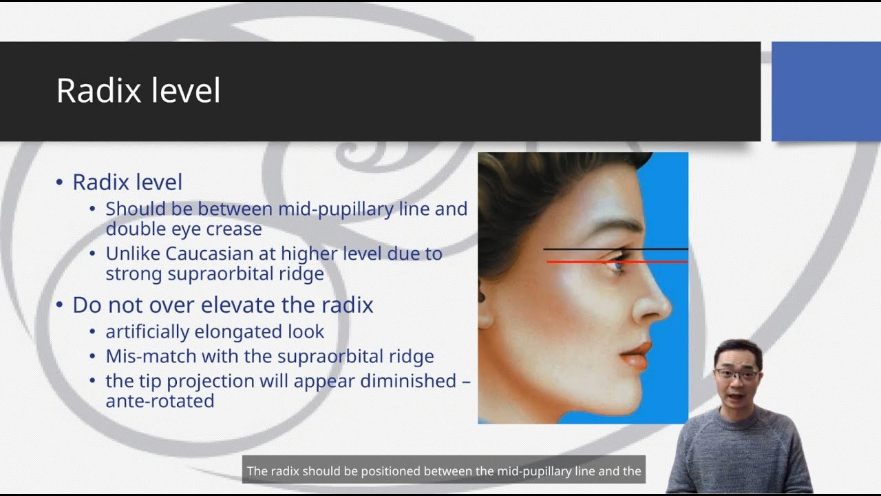 Radix correction - Structural approach for COG thread rhinoplasty 2 /8 ...