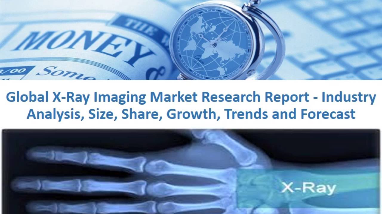 X-Ray Imaging Market Research Report Upto 2022 - YouTube