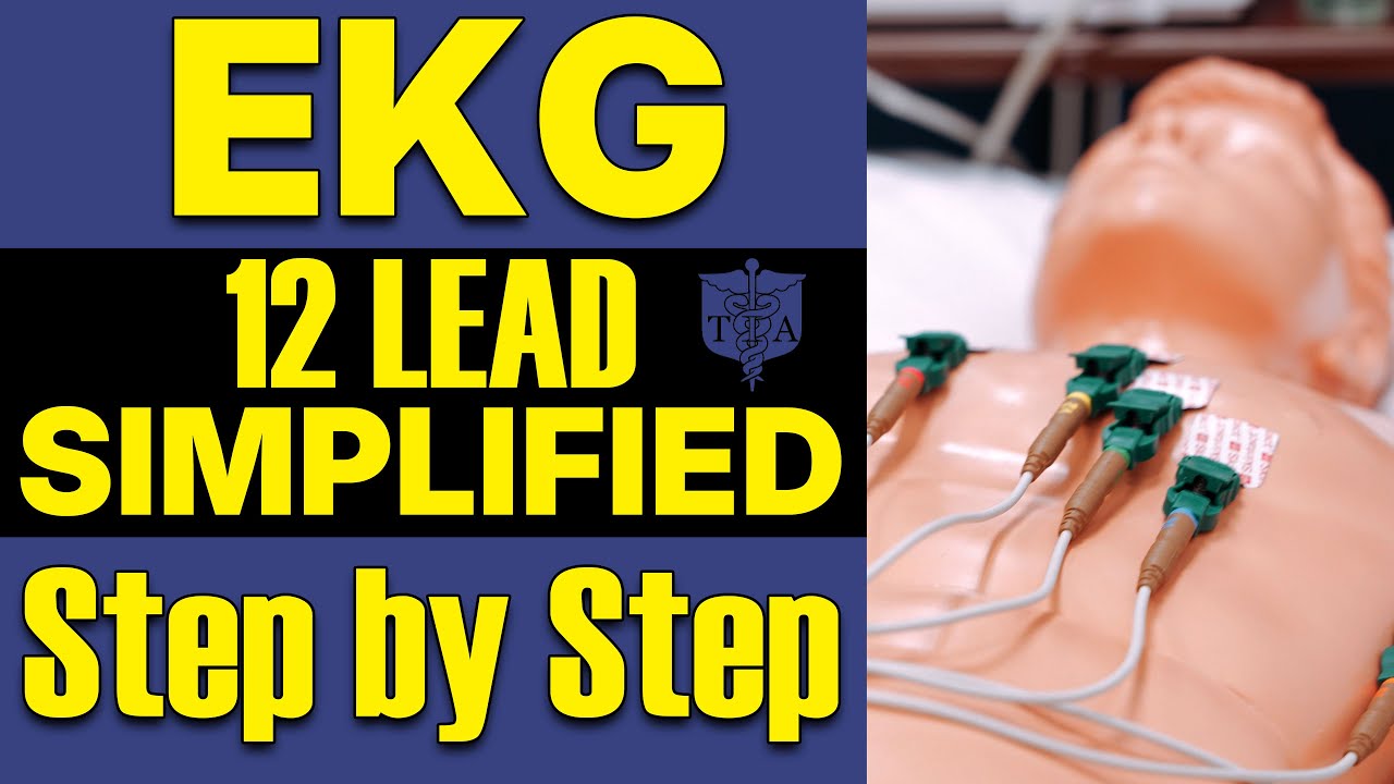 EKG Guide Under 6 Minutes! (Step-by-Step) - YouTube
