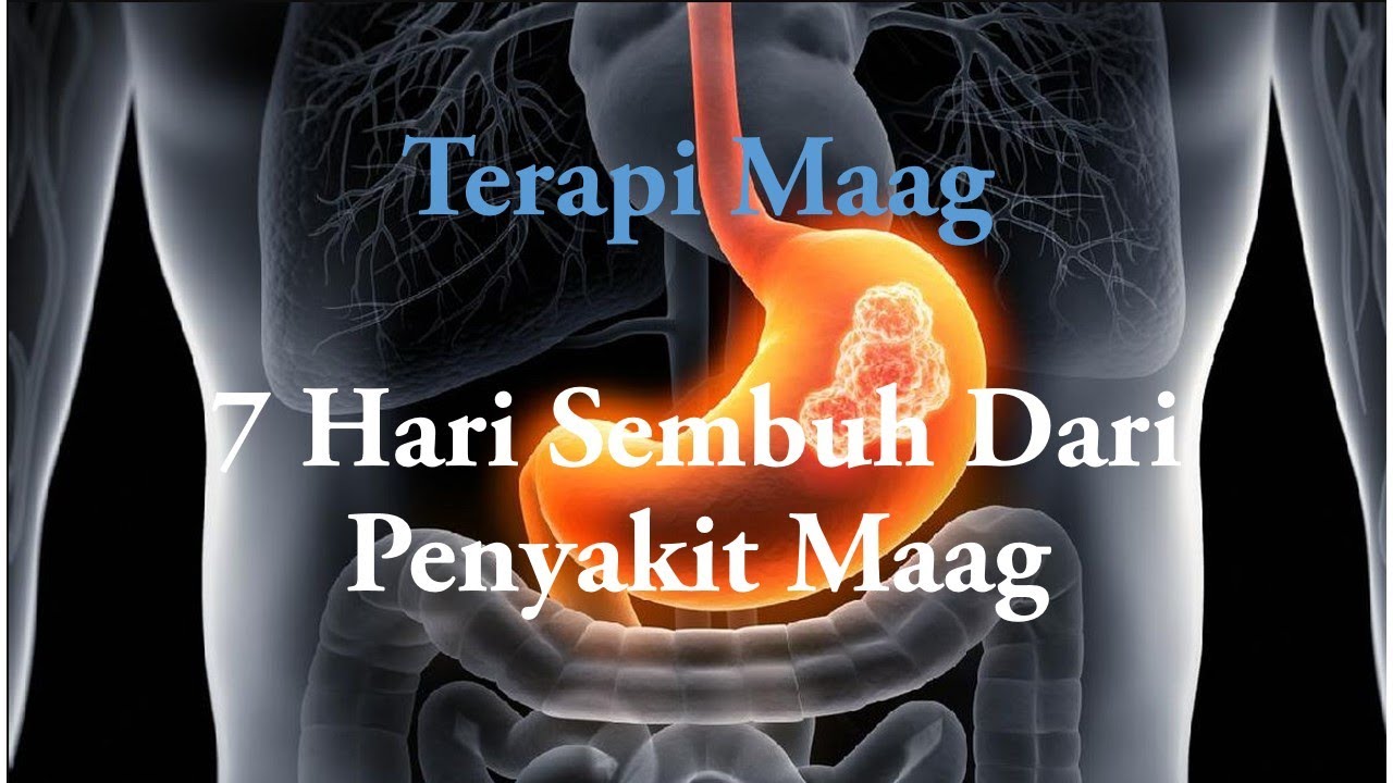 Lambung | Sakit Lambung | Maag | Obat Maag | Sakit Maag | Terapi Maag ...