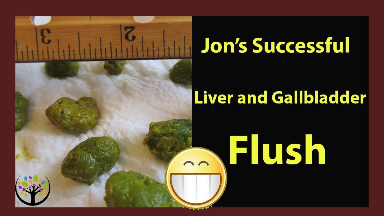 Overcoming Weight Gain After Water Fasting(Jon's Liver Flush Success ...