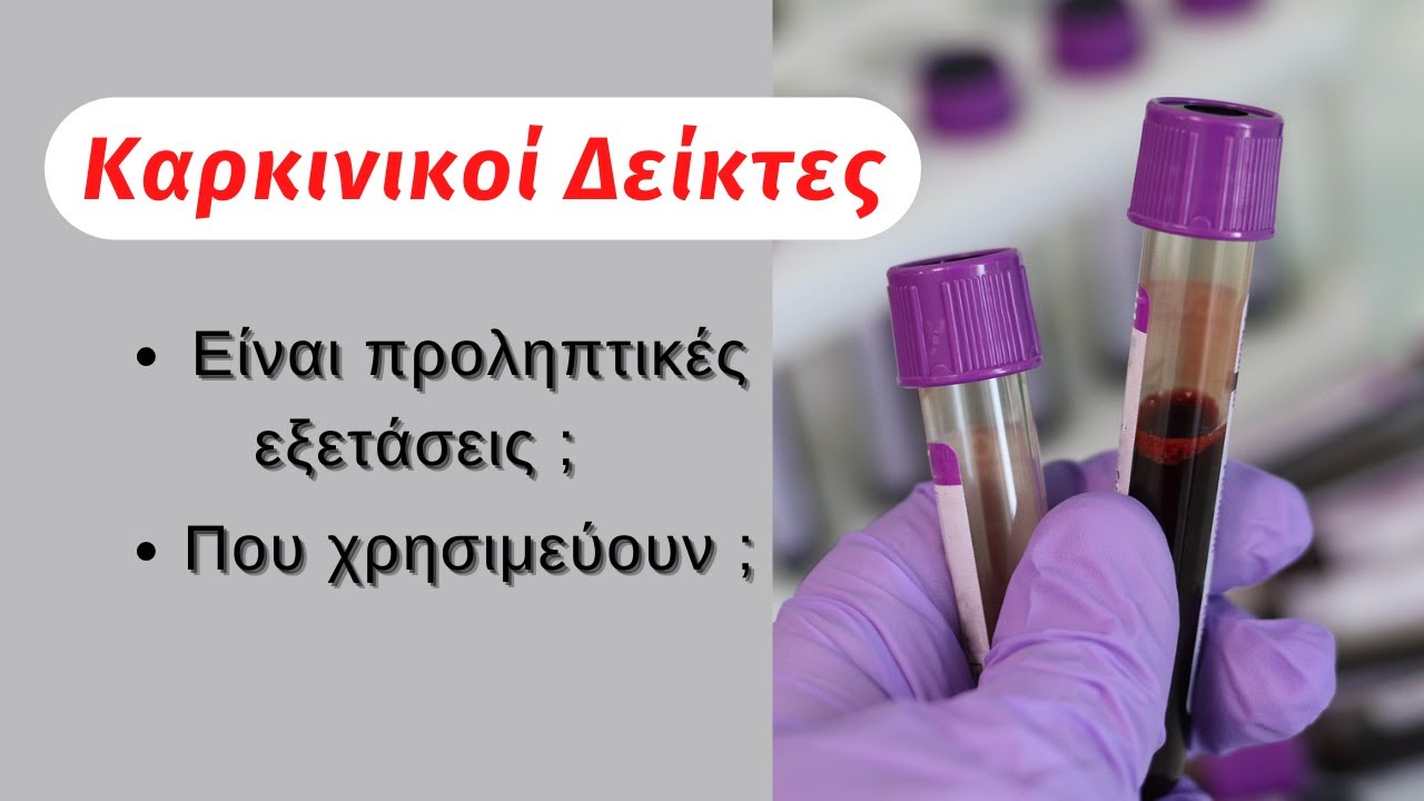 Καρκινικοί δείκτες: Τι είναι και που χρησιμεύουν - YouTube