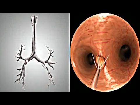 Bronchoscopy simulator - YouTube