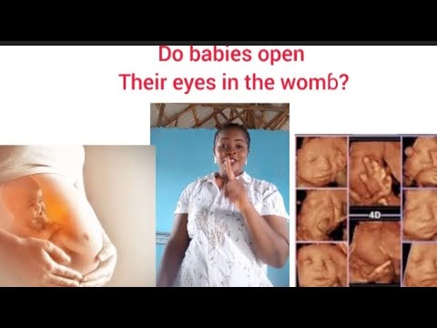 Do babies open their eyes in the womb? #pregnancy #mystery #moms