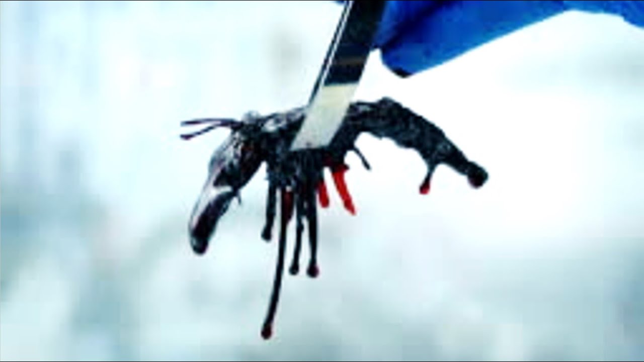 Scientists Make Chilling Discovery After Finding This Inside Human ...