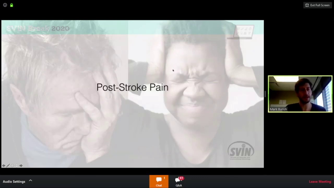 Post Stroke Pain and Headaches Burish - YouTube