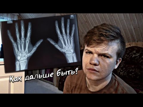 Зоны Роста закрыты! Можно ли Увеличить Рост, если закрыты Зоны Роста?!